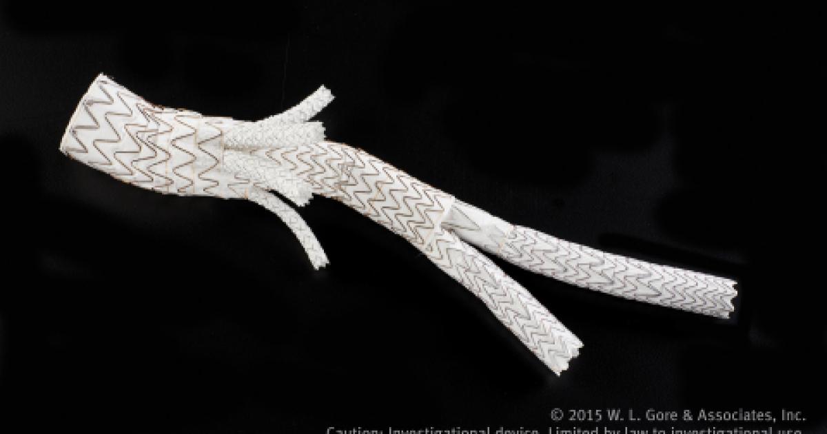 Final Subject Enrolled in Early Feasibility Study of the GORE® EXCLUDER ...