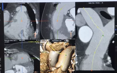 PHOTO GALLERY: Cardiac CT advances at SCCT 2022