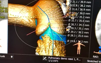 PHOTO GALLERY: Cardiac CT advances at SCCT 2022