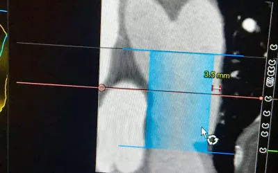 PHOTO GALLERY: Cardiac CT advances at SCCT 2022