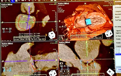 PHOTO GALLERY: Cardiac CT advances at SCCT 2022