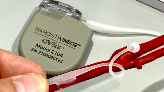 Implantable Barostim device improves long-term heart failure symptoms