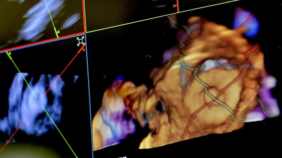 Siemens Healthineers and Boston Scientific partner on next-generation ...