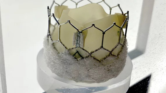 Newest TAVR valve from Edwards Lifesciences improves survival, real ...