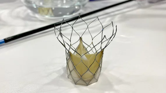 Abbott’s Navitor TAVR valve linked to positive real-world outcomes