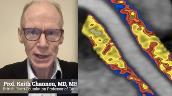 Computed Tomography | Cardiovascular Business