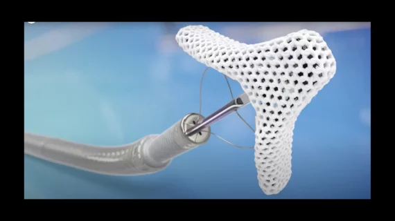 FDA panel to consider Abbott’s TriClip device for tricuspid regurgitation FDA panel to consider Abbott’s TriClip device for tricuspid regurgitation