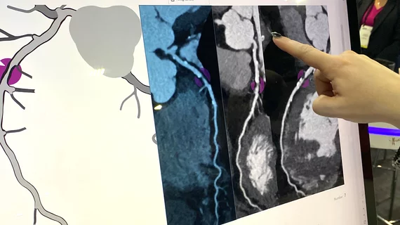 HeartFlow sharing new data on AI-enabled CAD management at TCT 2024