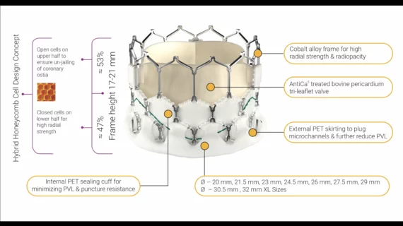 Myval TAVR valve outperforms Sapien and Evolut in the late-breaking ...