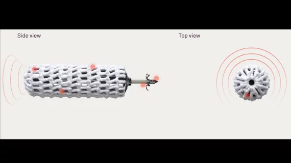 FDA approves leadless CRT device for heart failure
