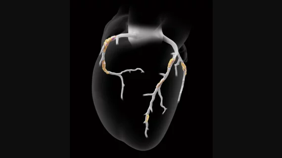 FDA clears next-generation platform for AI-powered heart assessments