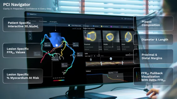 New Heartflow tech delivers AI-powered PCI planning for cardiologists