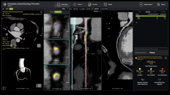 FDA clears new AI-enabled coronary plaque analysis software