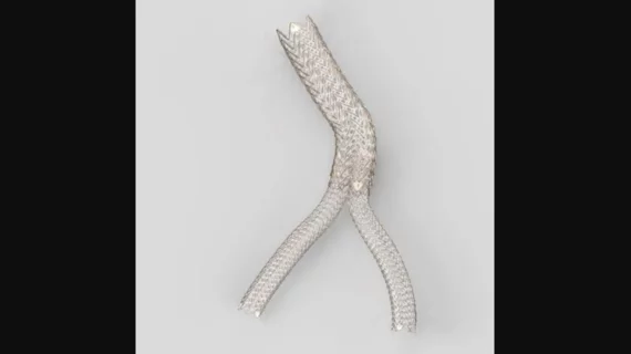 FDA approves new stent for deep venous disease