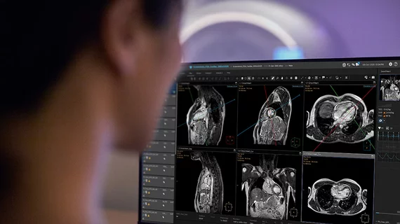 FDA clears AI-enabled cardiac MR planning technology from Philips