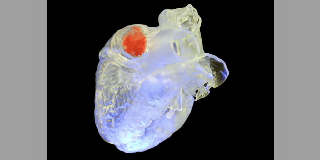 3d printer heart
